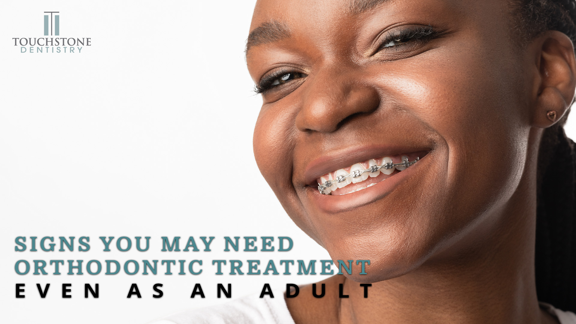 Orthodontist: Adult Braces & Invisalign in League City, TX | Touchstone ...